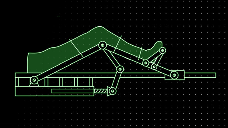 Learn how AI and the latest CPM technologies optimize patient ...